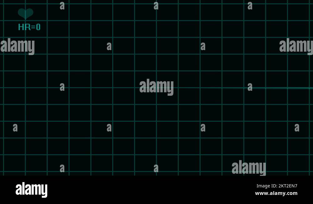 ECG EKG Electrocardiogram Monitor Dead Line blue Stock Video Footage ...
