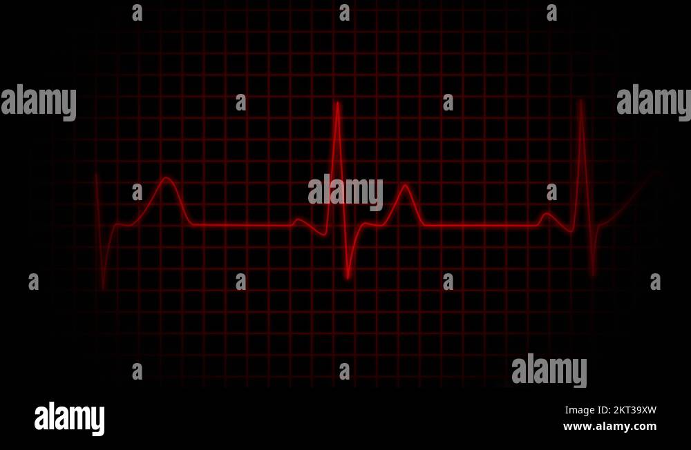 Ekg Stock Videos & Footage - HD and 4K Video Clips - Alamy