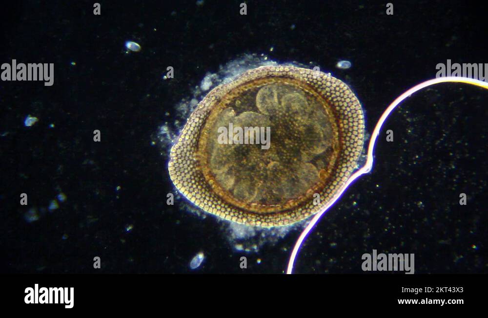 Microscopic Seed Stock Video Footage - Alamy