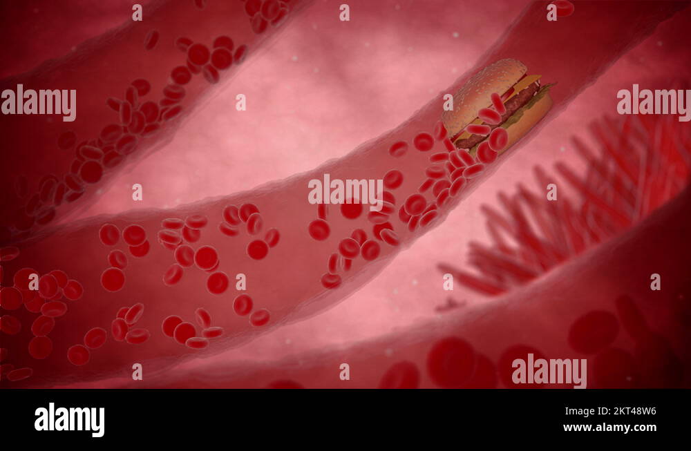 Blocked blood flow Stock Videos & Footage - HD and 4K Video Clips - Alamy