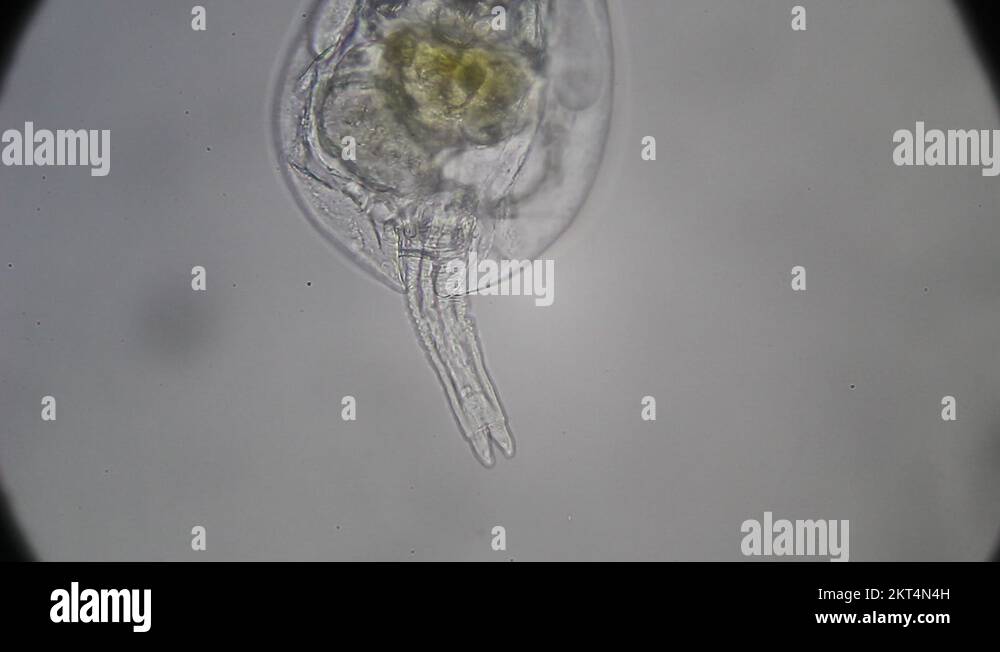 Microscope - Rotifero Brachionus Plicatilis Stock Video Footage - Alamy