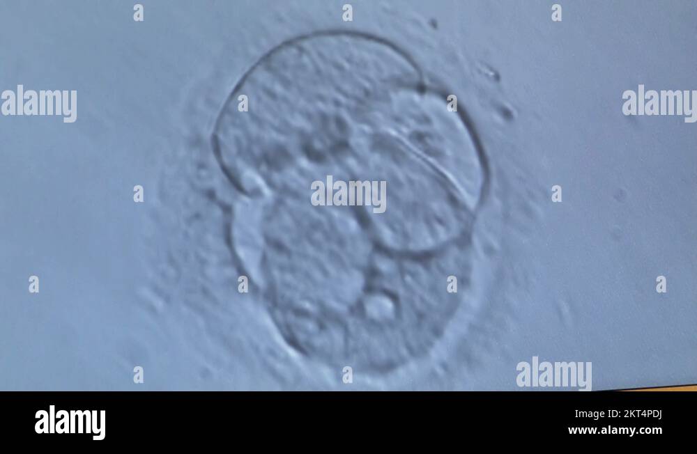 Cellular division of an in vitro fetus under microscope. Generic cell ...