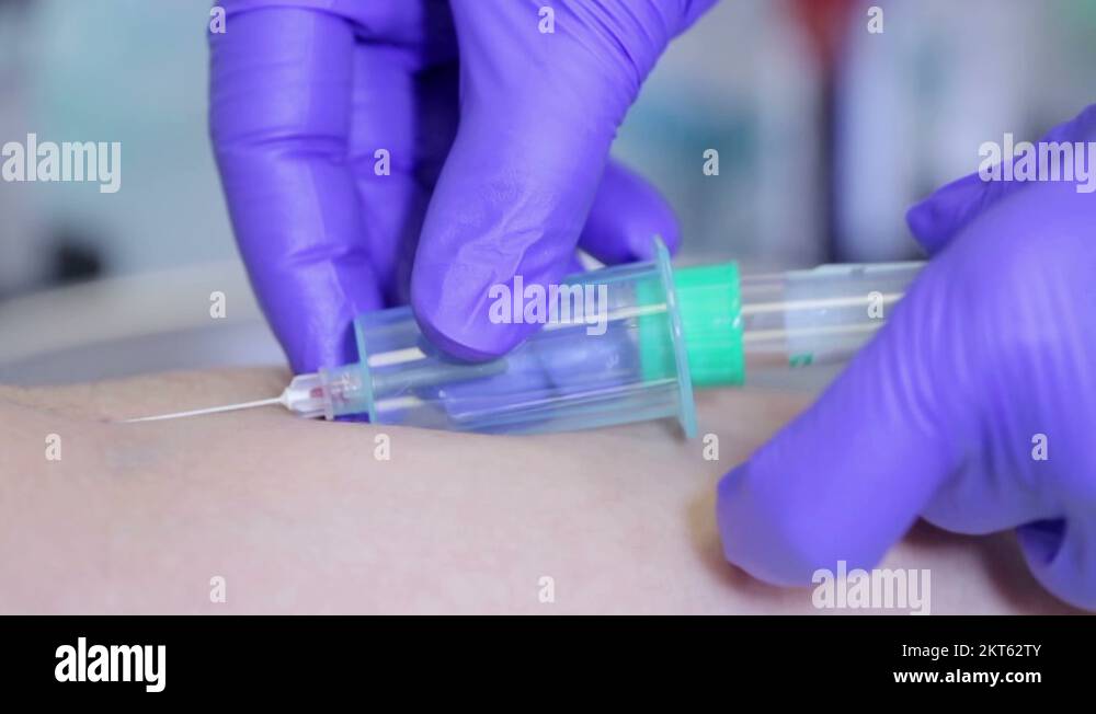 Rubber hand experiment arm Stock Videos & Footage - HD and 4K Video ...