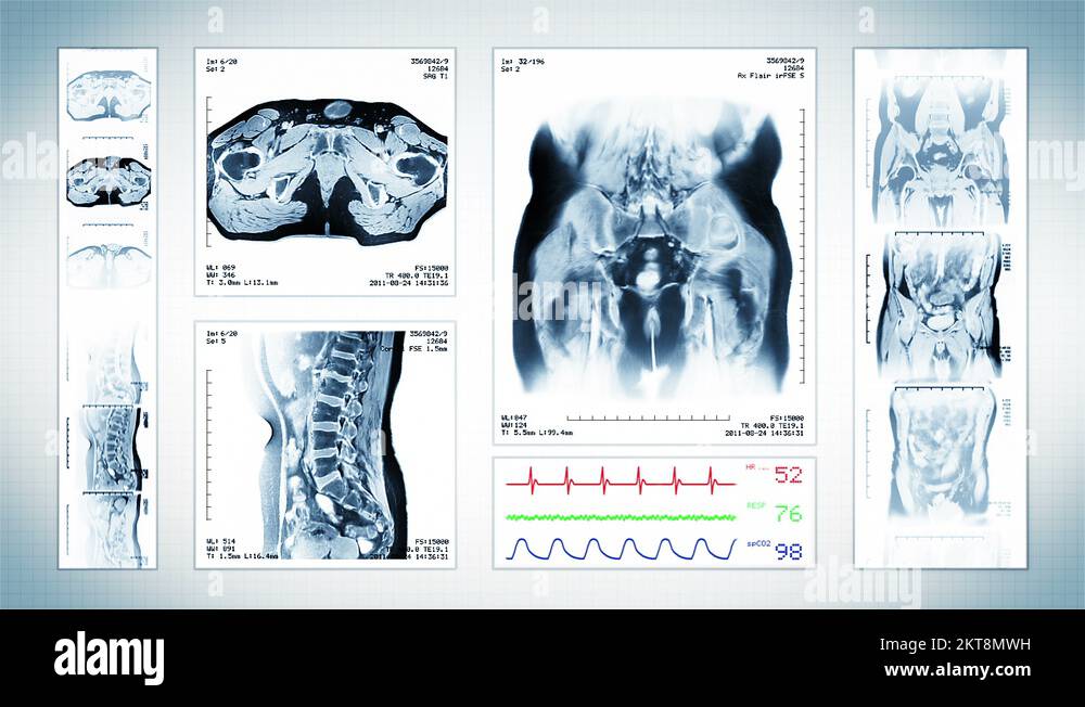 Pelvis MRI Scan. White. 4 in 1. Top, front, lateral view and ECG ...
