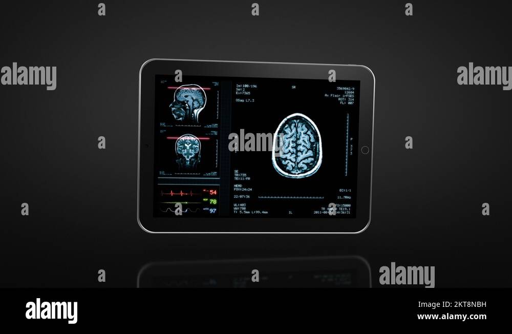 Spinning Tablet animation. Brain MRI scan video on the display Stock ...