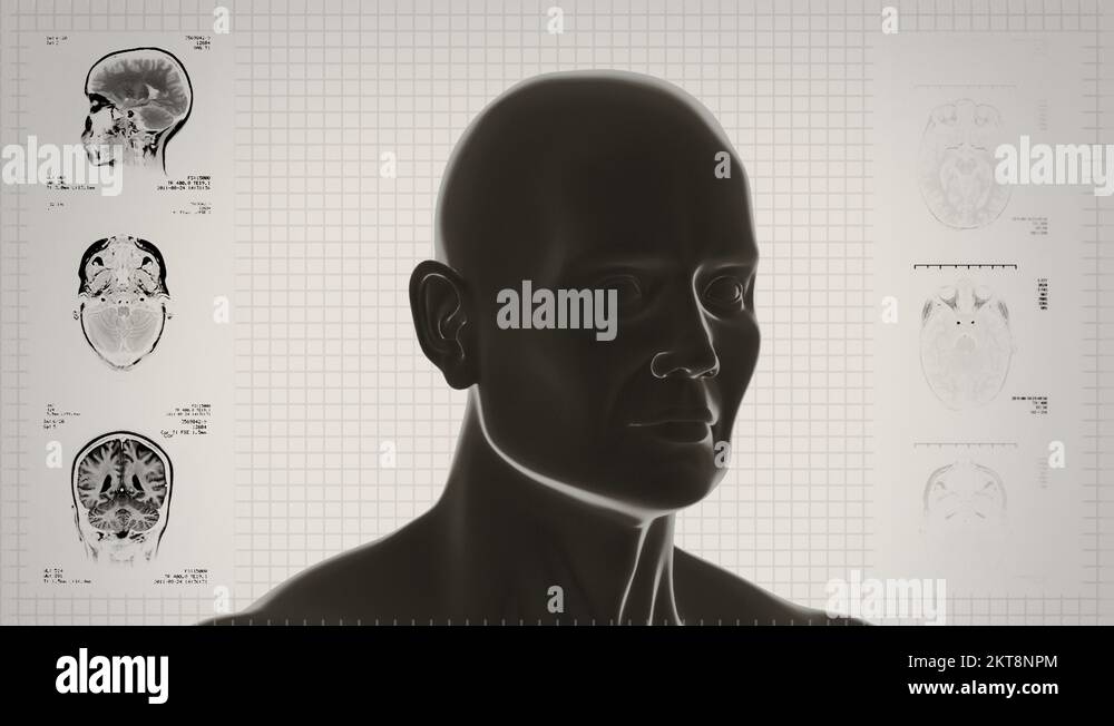 Highly detailed head scan. Loopable. Black/white. White background ...