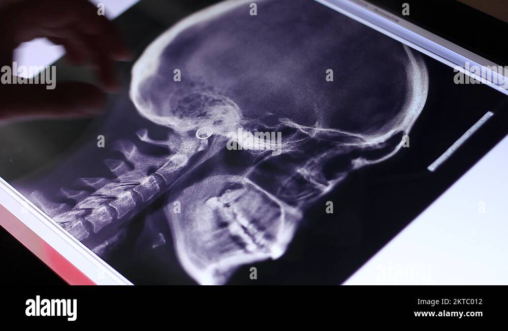 Fluorography scan Stock Videos & Footage - HD and 4K Video Clips - Alamy
