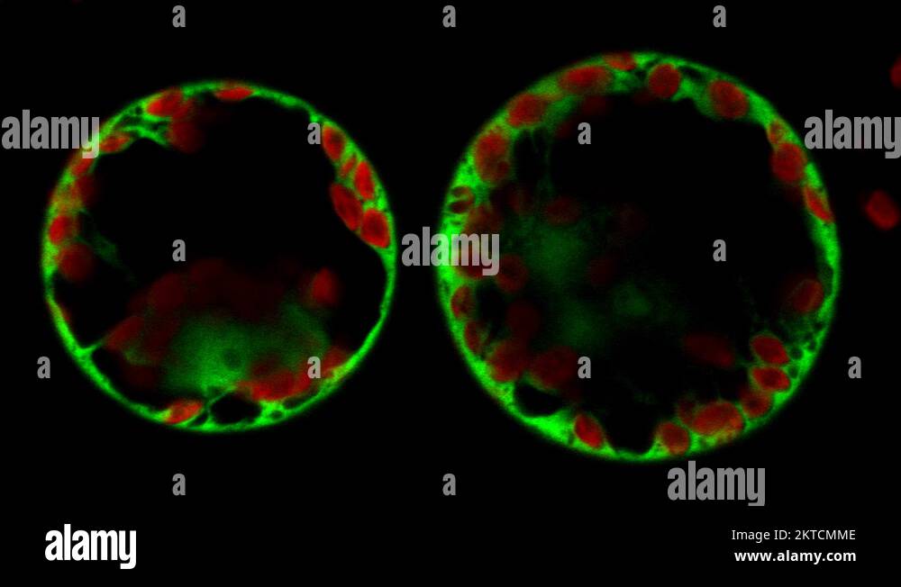 Protoplasts (plant cells without cell wall) expressing green ...