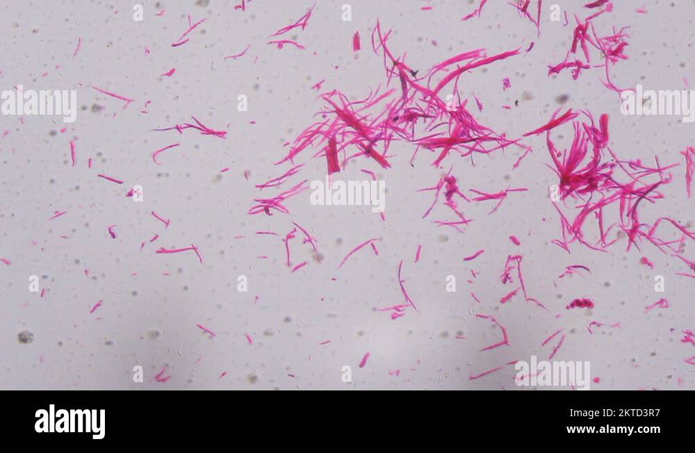 Smooth muscle microscope Stock Videos & Footage - HD and 4K Video Clips ...
