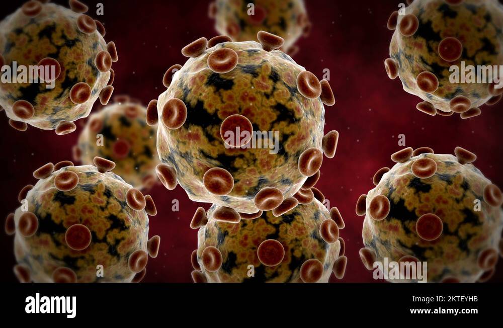 Arbovirus disease Stock Videos & Footage - HD and 4K Video Clips - Alamy
