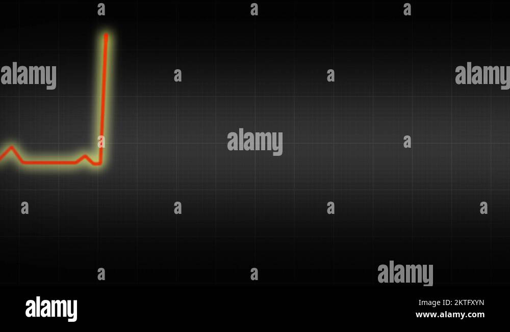 Electrocardiography ecg Stock Videos & Footage - HD and 4K Video Clips ...