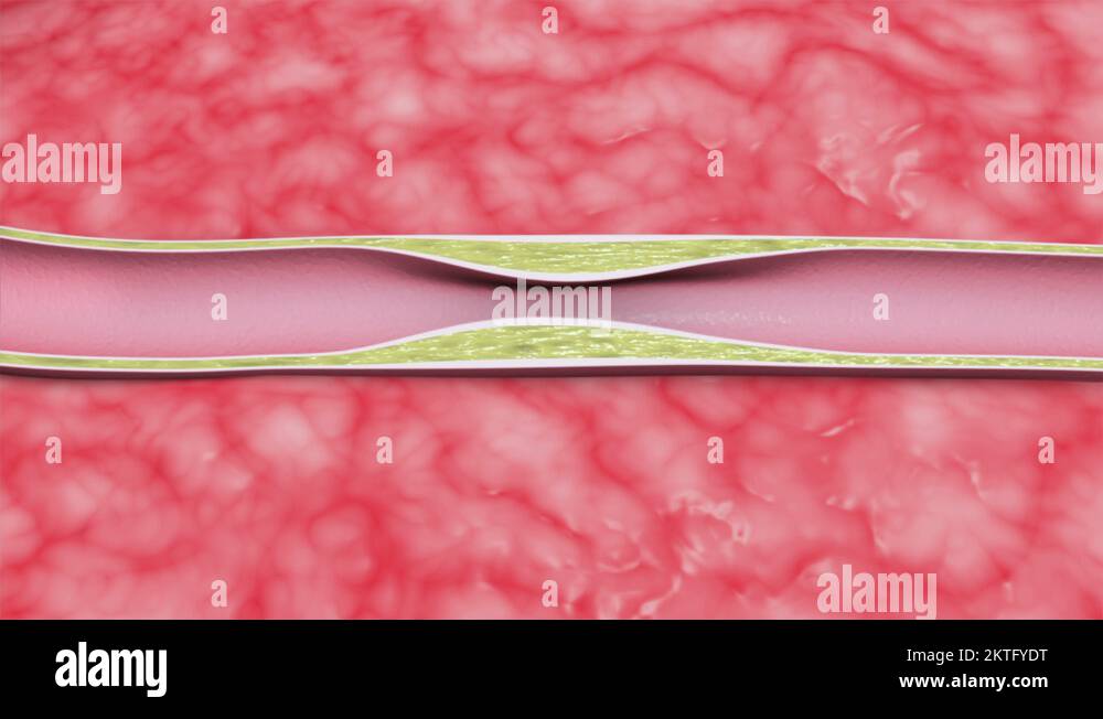 Artery cross section Stock Videos & Footage - HD and 4K Video Clips - Alamy