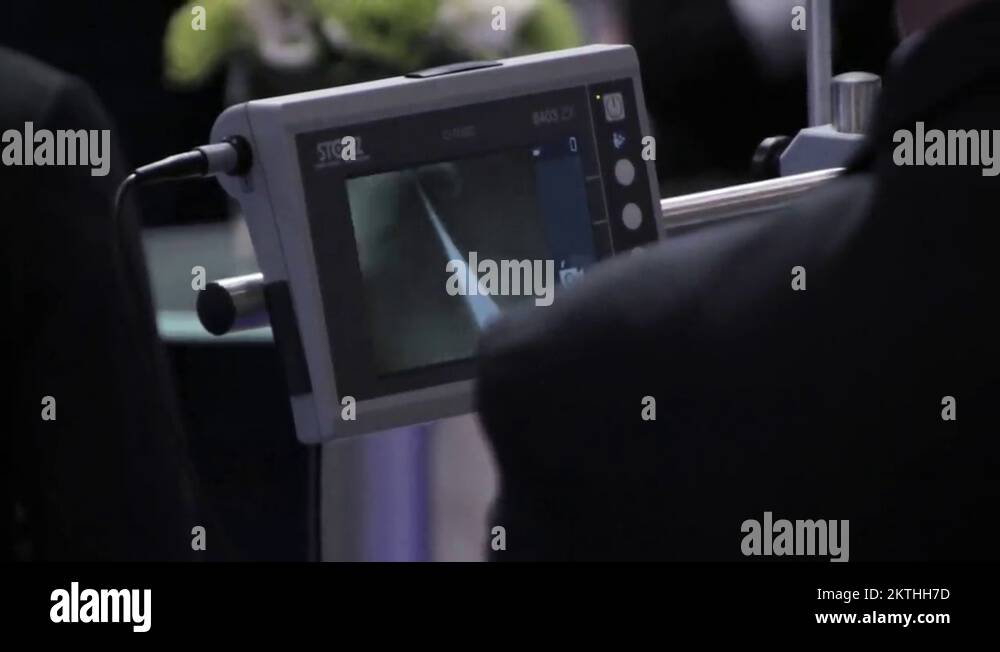 Peritoneoscope Stock Videos & Footage - HD and 4K Video Clips - Alamy