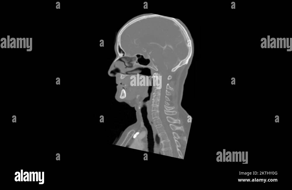 Ct scan neck head Stock Videos & Footage - HD and 4K Video Clips - Alamy