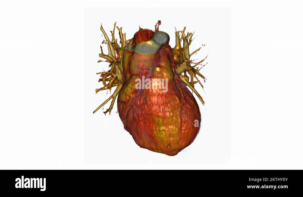 Cardiac ct scan Stock Videos & Footage - HD and 4K Video Clips - Alamy
