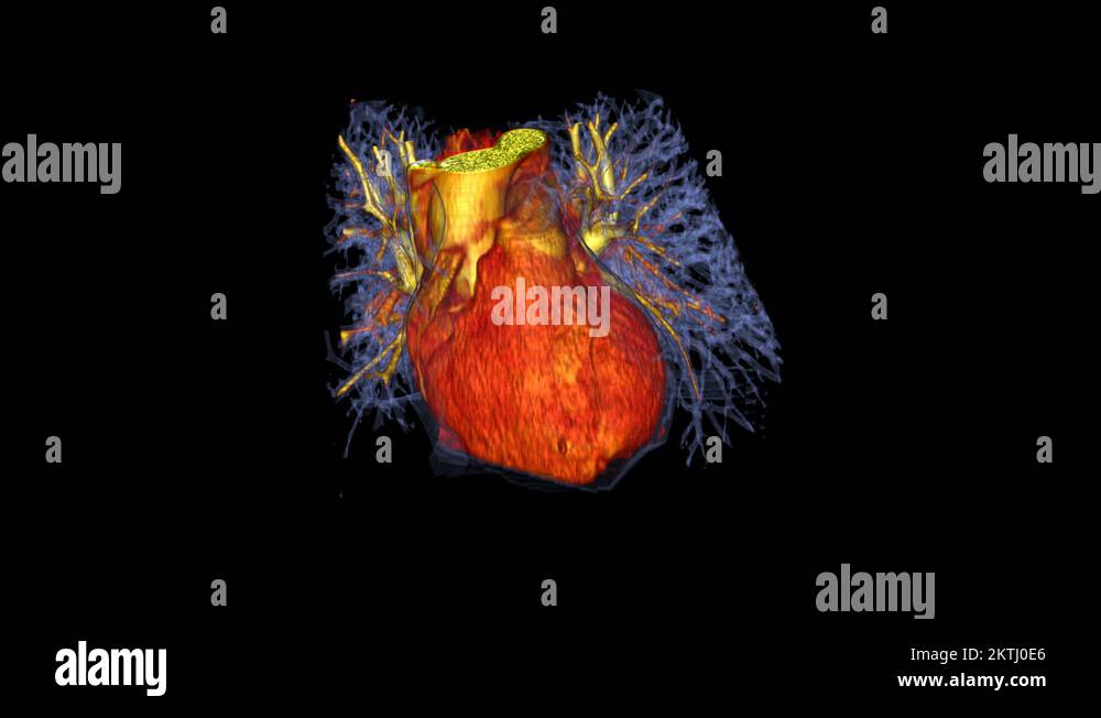 Cardiovascularsystem Stock Videos & Footage - HD and 4K Video Clips - Alamy