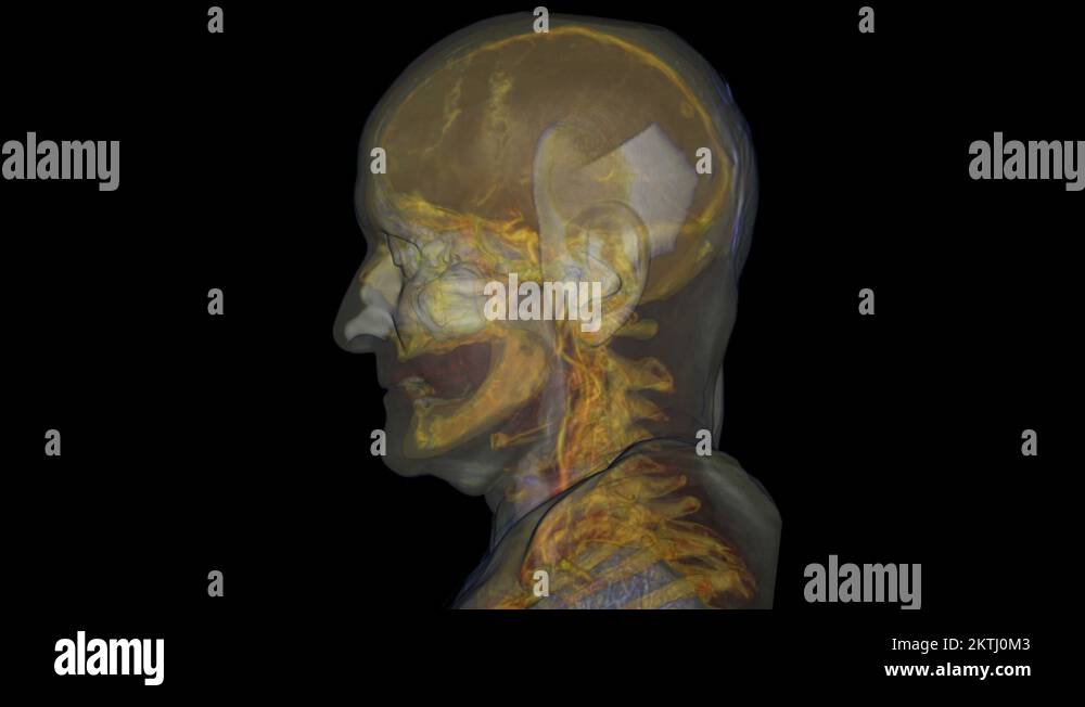 3d ct scan head neck Stock Videos & Footage - HD and 4K Video Clips - Alamy
