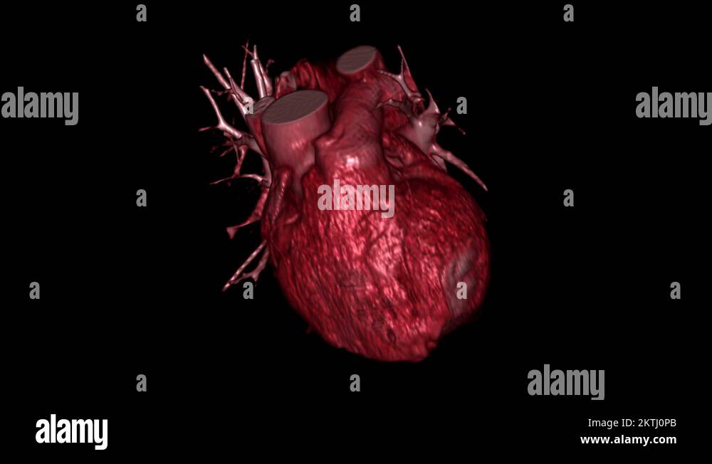 Ct scan human male Stock Videos & Footage - HD and 4K Video Clips - Alamy