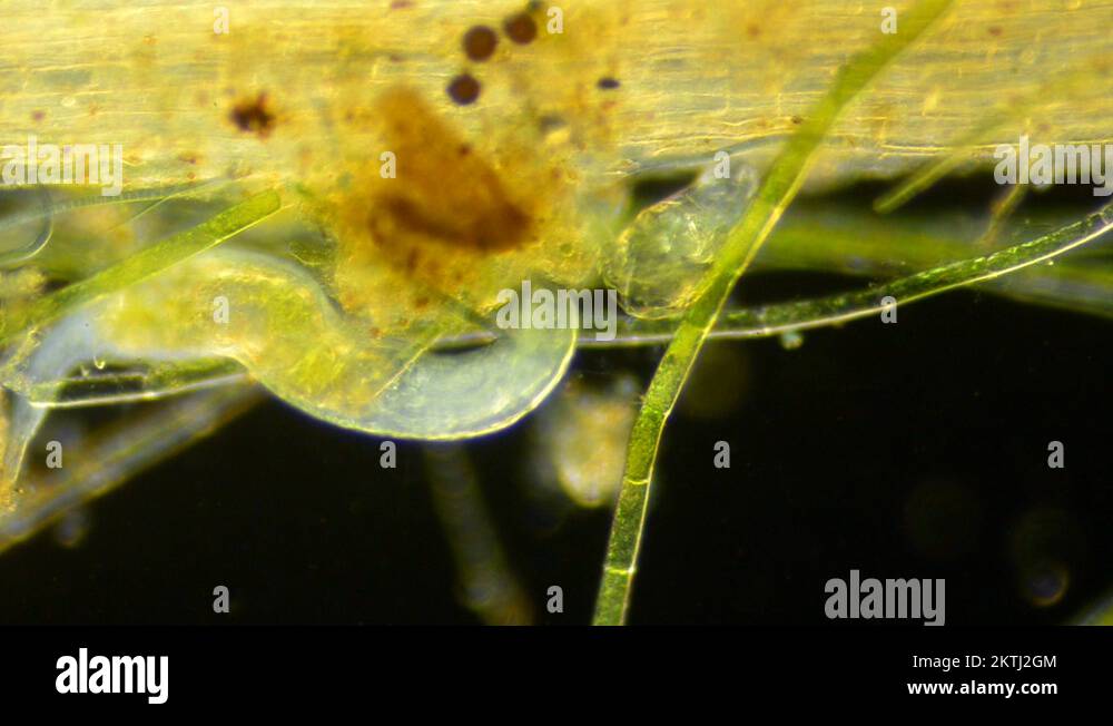 Flat worm (Microdalyellia sp.), rotifer (Rotaria sp.) and rotifer ...