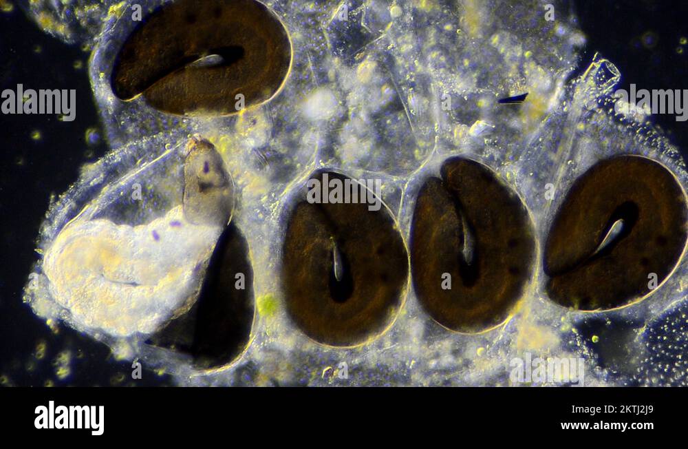 Diptera larva hatching Stock Videos & Footage - HD and 4K Video Clips ...