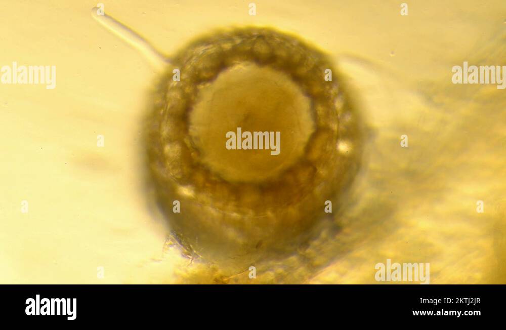 Microscopy amoeba Stock Videos & Footage - HD and 4K Video Clips - Alamy
