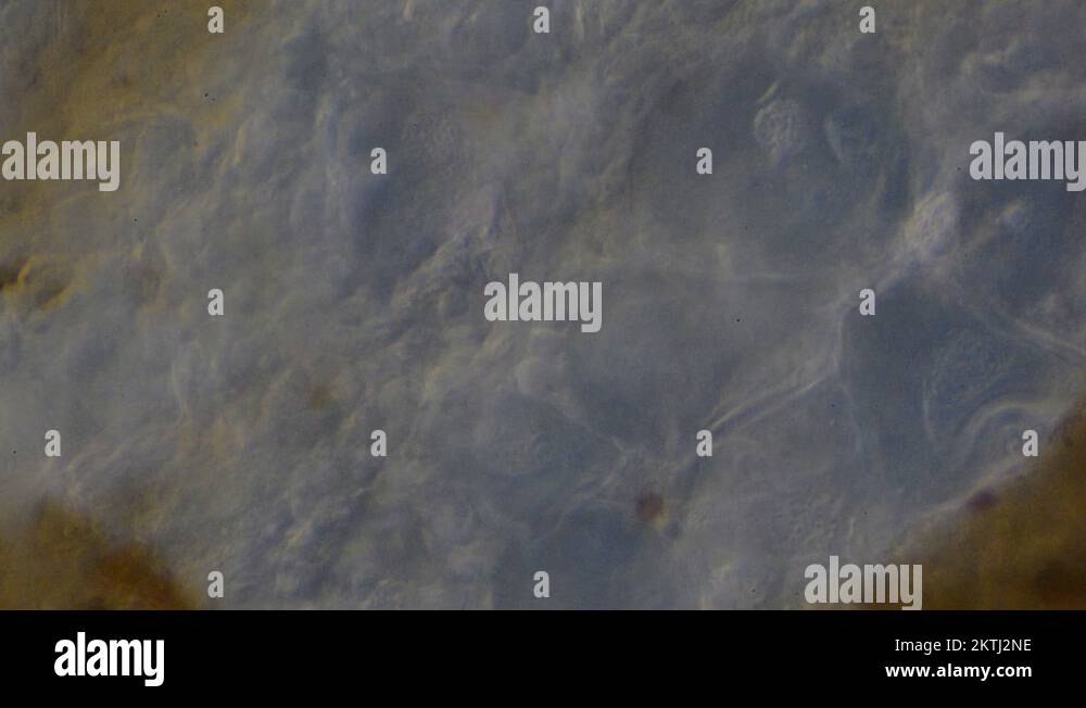 Symbiont protozoa (Trichonympha sp.) from termite gut Stock Video ...