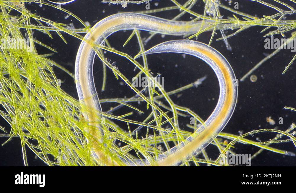 Nematode animal Stock Videos & Footage - HD and 4K Video Clips - Alamy