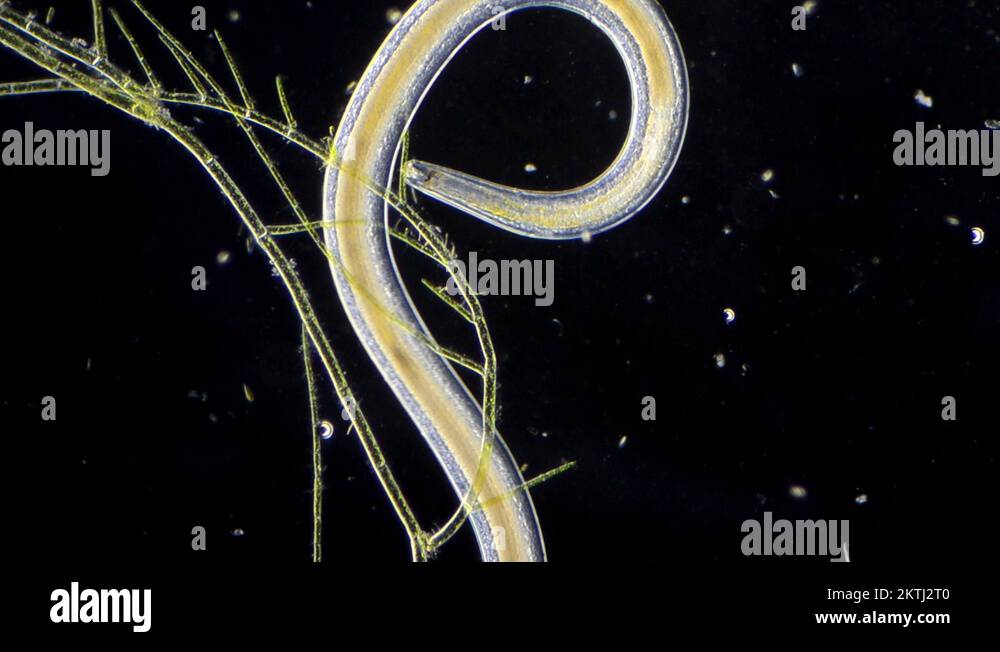Nematode worm aquatic Stock Videos & Footage - HD and 4K Video Clips - Alamy