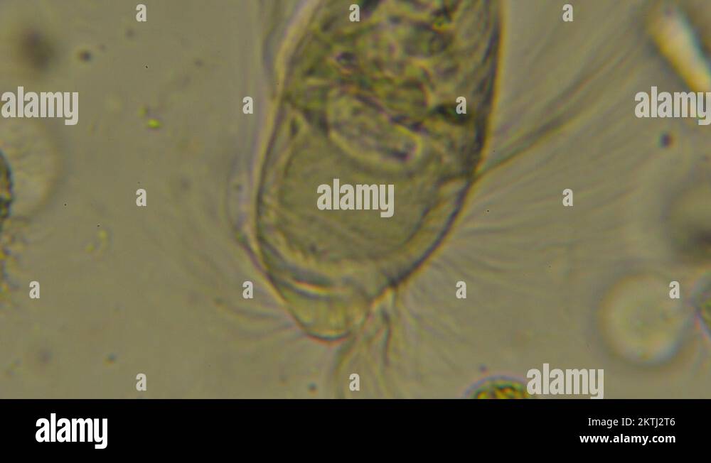 Symbiont protozoa (Trichonympha sp.) from termite gut Stock Video ...