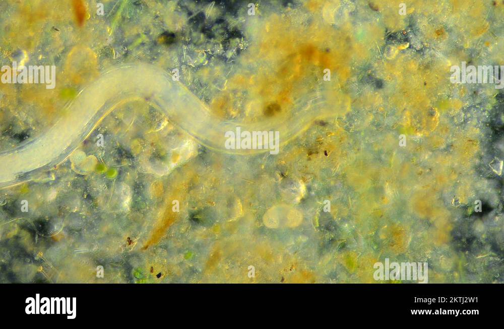 Nematode soil Stock Videos & Footage - HD and 4K Video Clips - Alamy