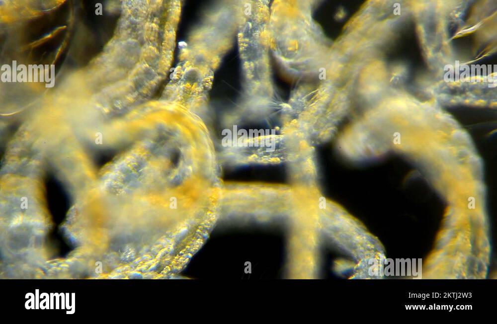 Midge egg Stock Videos & Footage - HD and 4K Video Clips - Alamy