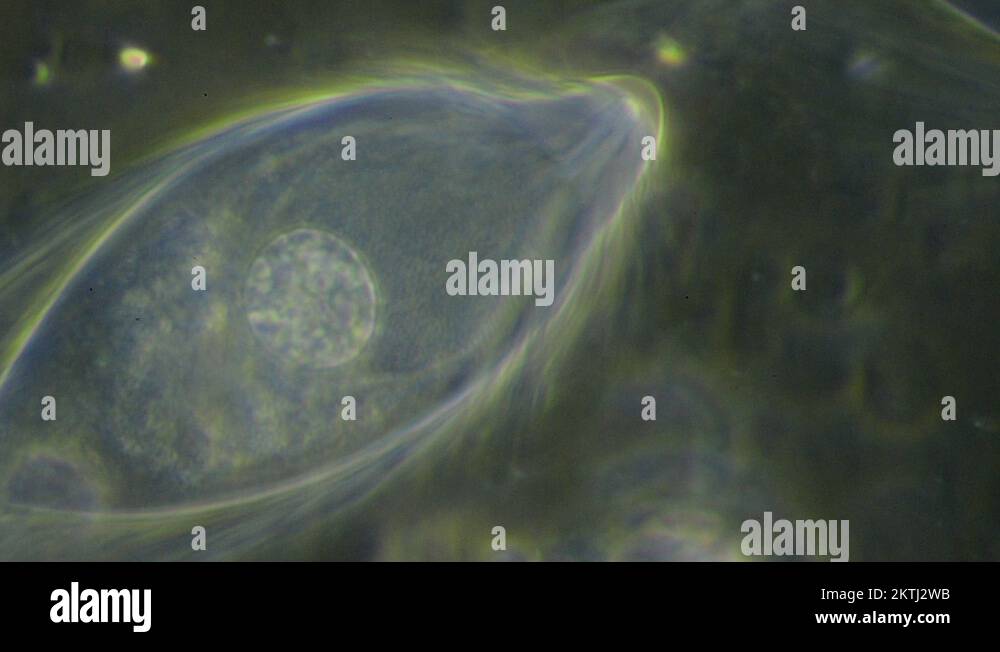 Symbiont protozoa (Trichonympha sp.) from termite gut Stock Video ...