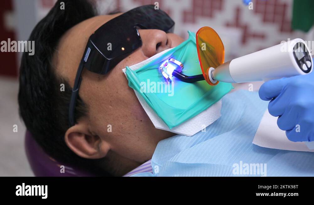 Hand of dentist holding an LED lamp in oral cavity of patient with ...