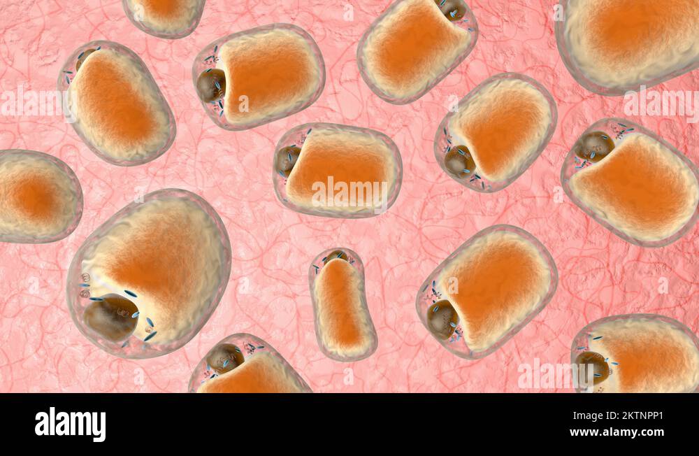 Human fat tissue Stock Videos & Footage - HD and 4K Video Clips - Alamy