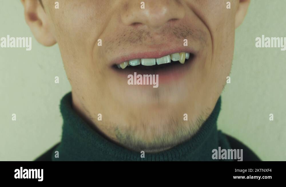 Man smile mouth teeth Stock Videos & Footage - HD and 4K Video Clips ...