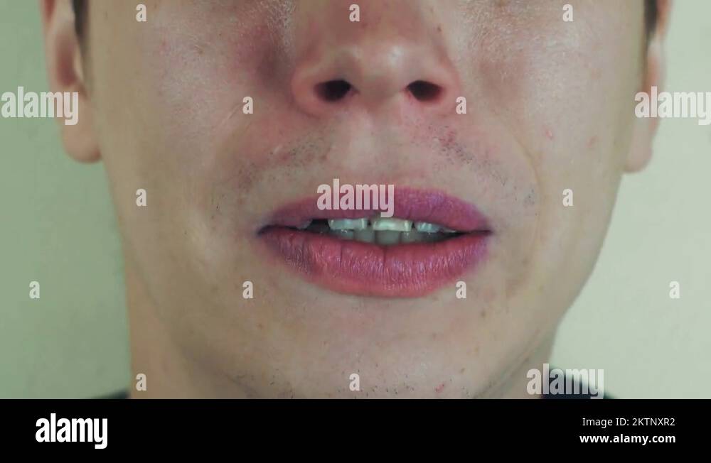 Man teeth mouth open Stock Videos & Footage - HD and 4K Video Clips - Alamy