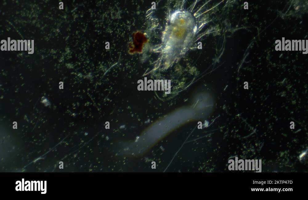 Study of allergy Stock Videos & Footage - HD and 4K Video Clips - Alamy