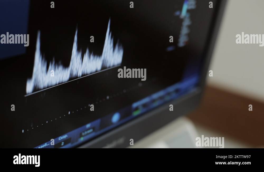 Scanner screen Stock Videos & Footage - HD and 4K Video Clips - Alamy