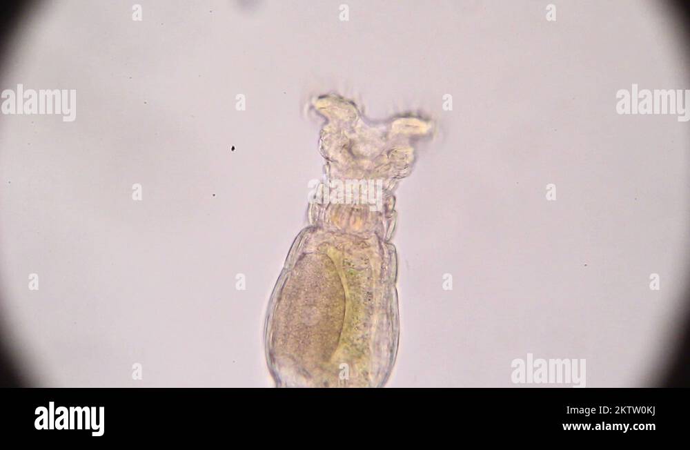 Phylum rotifera Stock Videos & Footage - HD and 4K Video Clips - Alamy