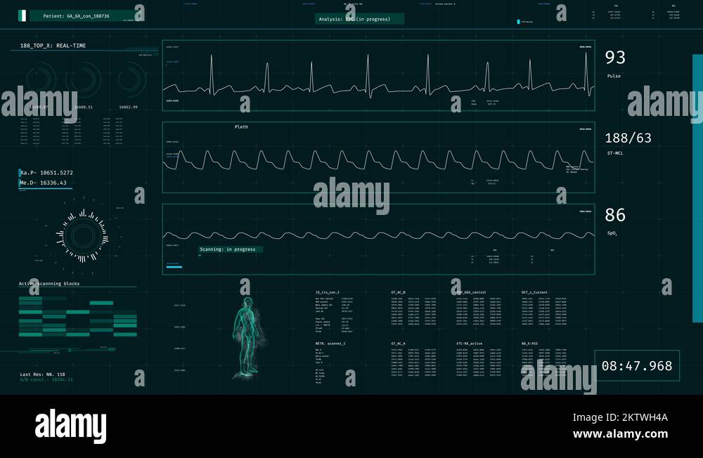 ICU monitor showing patient's condition, health, vital signs. Modern ...
