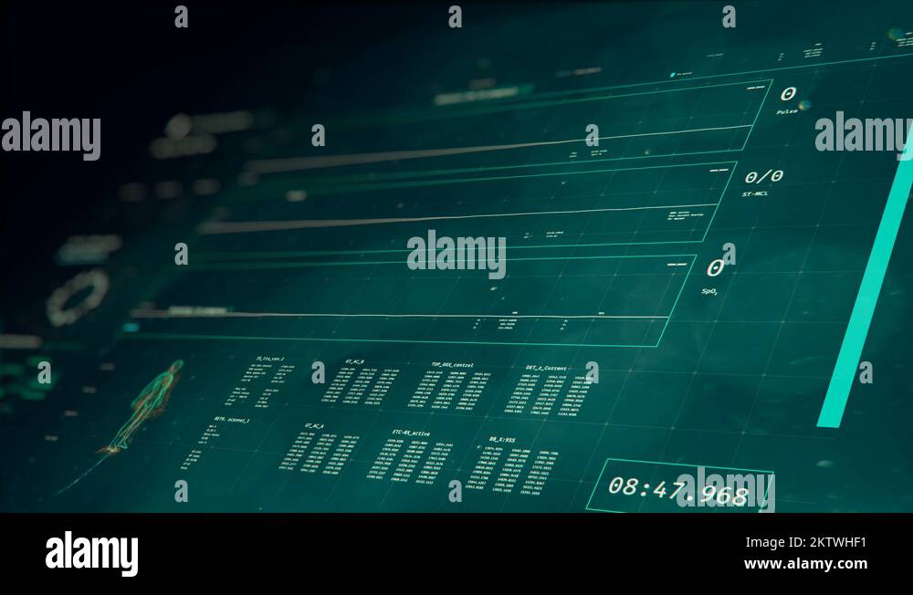 Clinical death and reviving on ICU monitor, patient lives ...