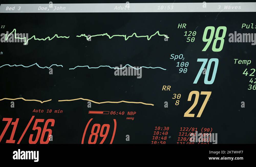 Cardiac monitor vital signs Stock Videos & Footage - HD and 4K Video ...