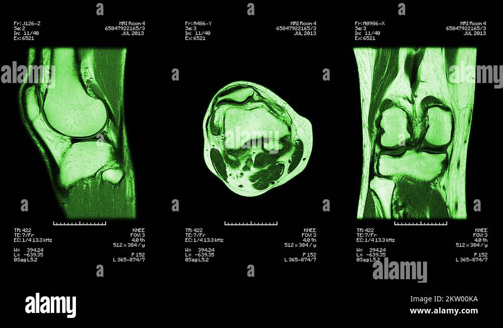 Mri scan both leg Stock Videos & Footage - HD and 4K Video Clips - Alamy