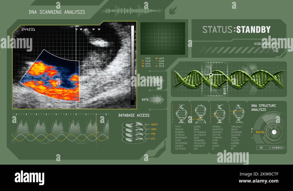 Uterus scan Stock Videos & Footage - HD and 4K Video Clips - Alamy