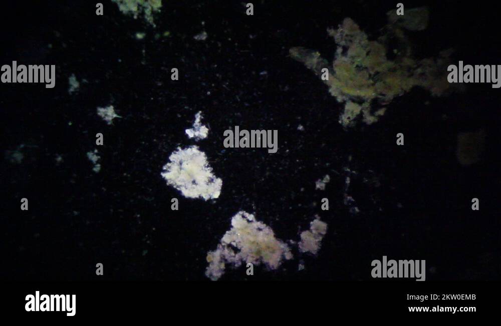 Brightfield microscope Stock Videos & Footage - HD and 4K Video Clips ...