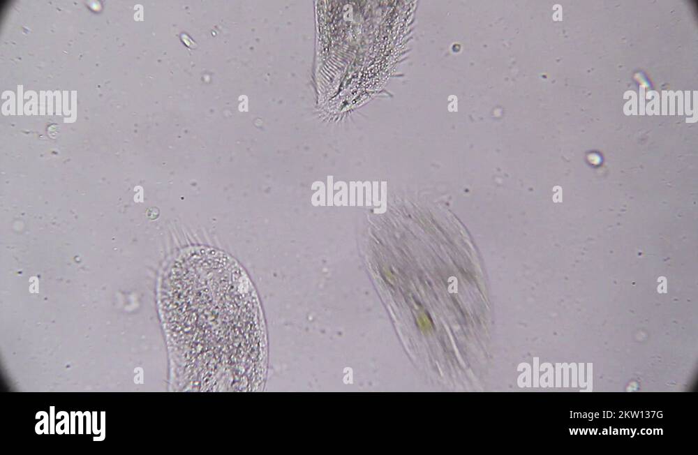 Ciliophora Stock Videos & Footage - HD and 4K Video Clips - Alamy