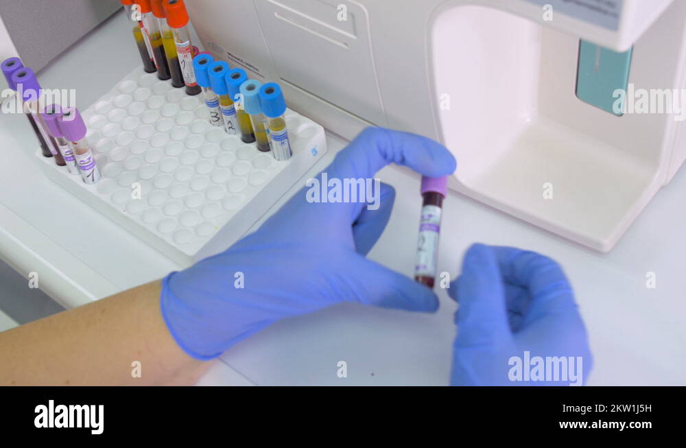 Technician test tubes testing Stock Videos & Footage - HD and 4K Video ...