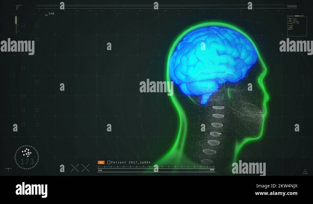 Patient's brain scan test results on screen, disease diagnostics and ...