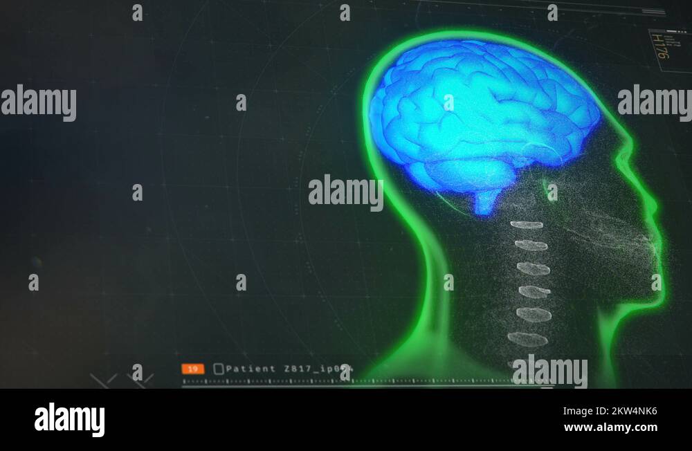 Medical software monitoring patient's brain activity, MRI test results ...
