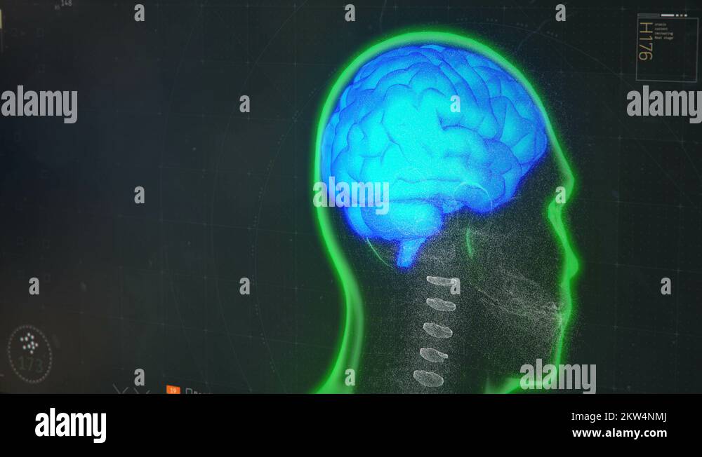 Human brain model spinning on screen, computer program showing scan ...